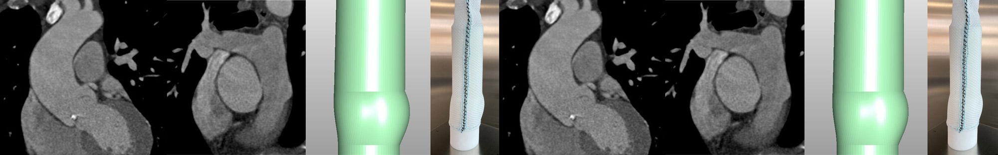 Ross-PEARS | eXstent