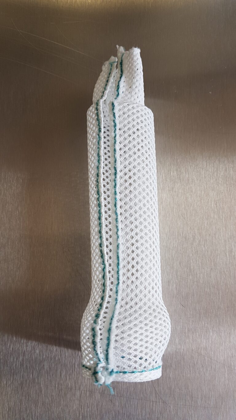 200th patient receives innovative Ross-PEARS implant | eXstent