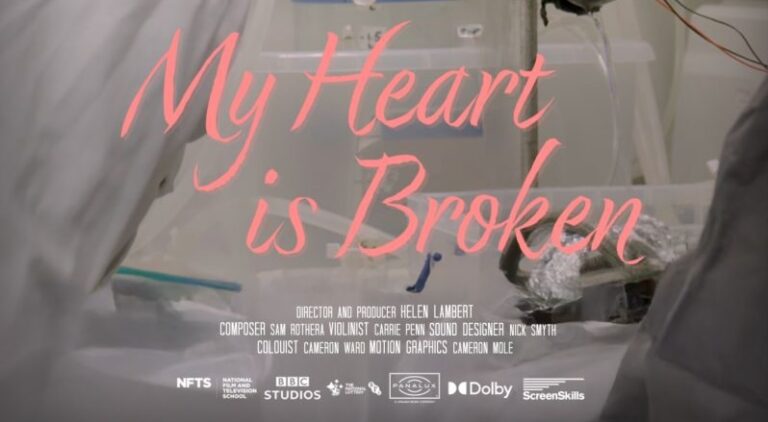 eXstent | Creators of ExoVasc® Personalised External Aortic Root ...